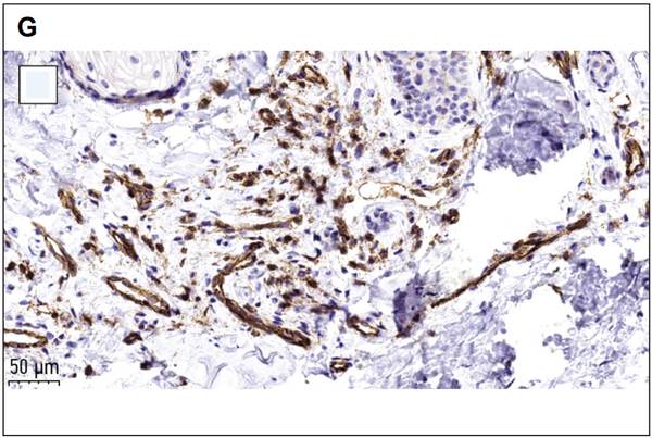‘노화 지우고 젊은 피부 살린다’…재생 에스테틱 중심 선 ‘레디어스’