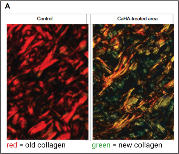 ‘노화 지우고 젊은 피부 살린다’…재생 에스테틱 중심 선 ‘레디어스’